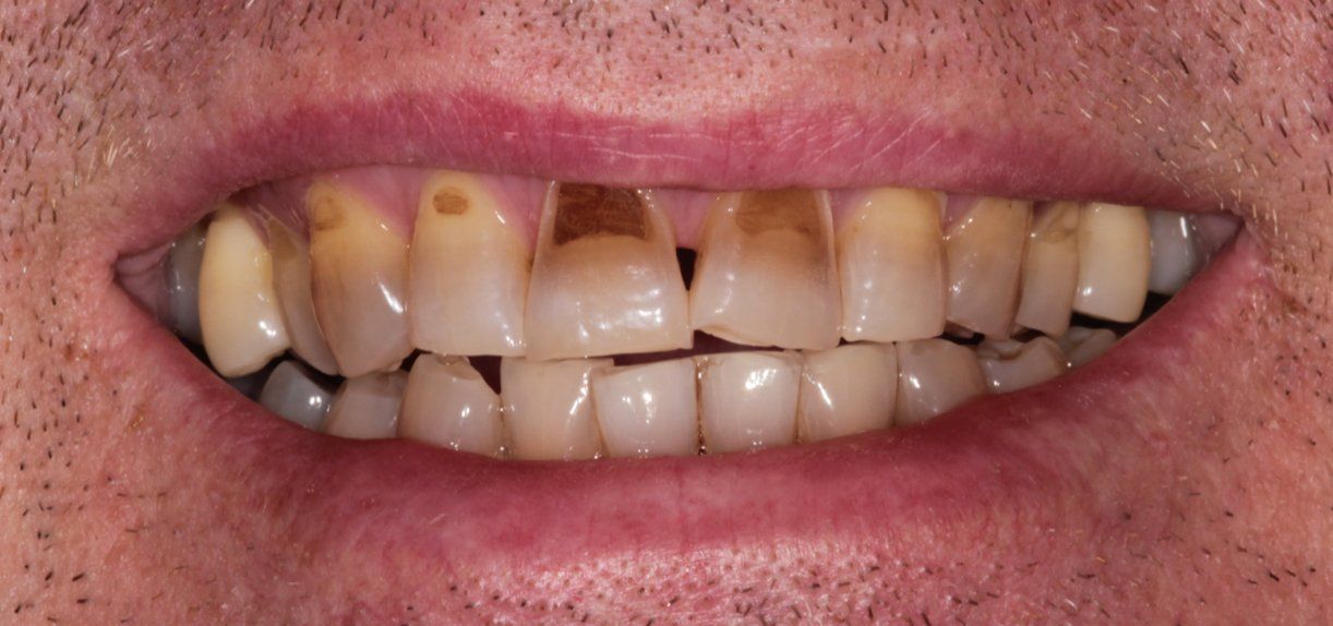 Sandy Limerick | Dental Implants and Restorative Dentistry