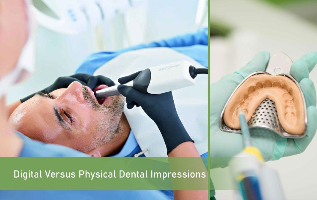 Digital Versus Physical Dental Impressions