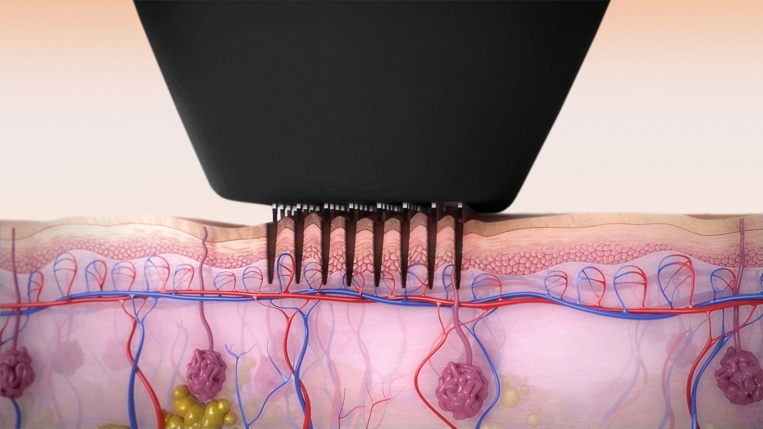 Venus Versa Pro™ | Multifunction Aesthetic Treatment Machine
