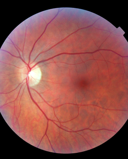 Ophthalmologists | Central Arizona | Risser Thomas Eye Clinic