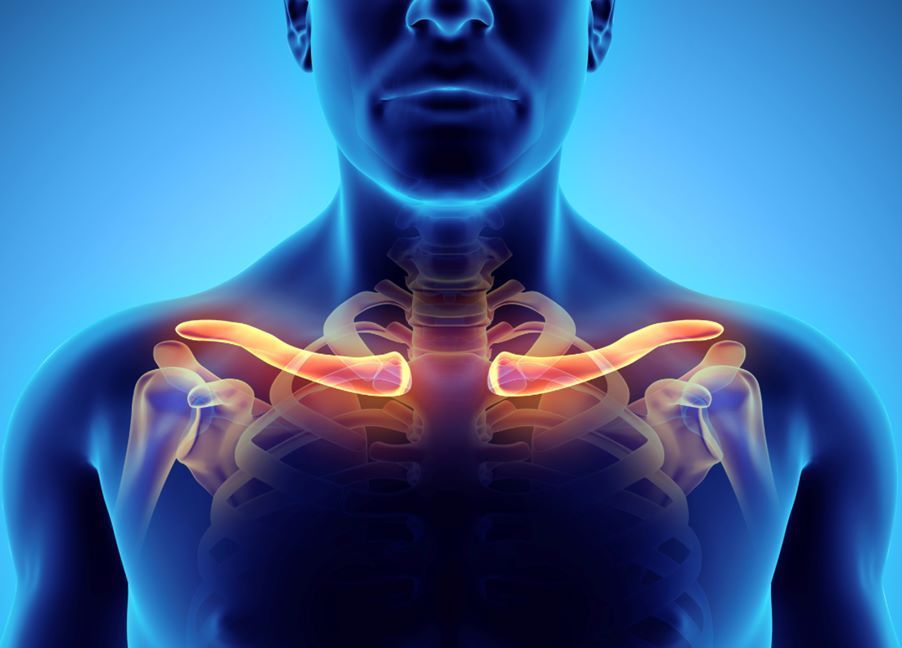 Thoracic outlet syndrome (TOS): how to diagnose it and how to treat it?