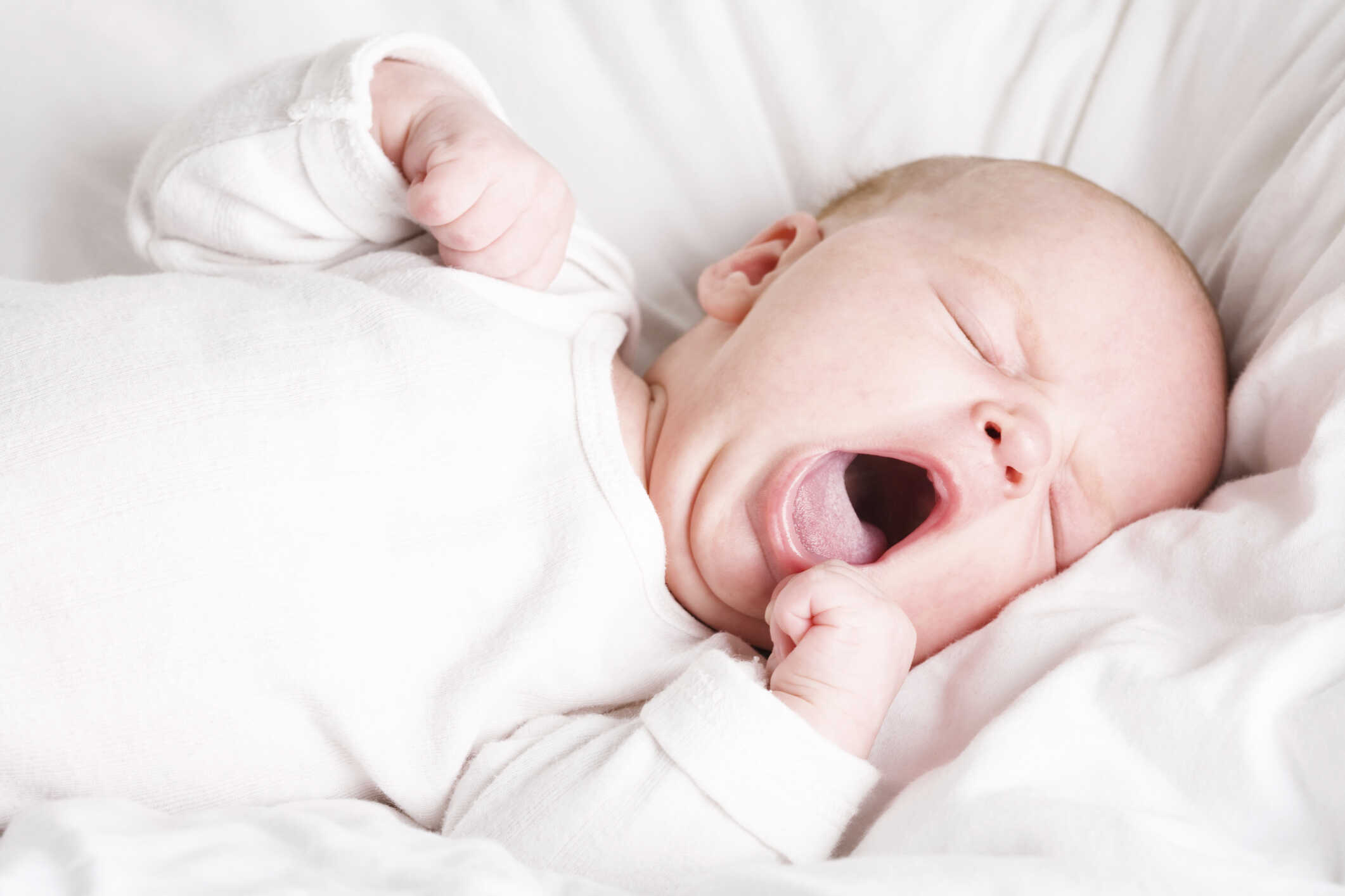 La costra láctea de los bebés