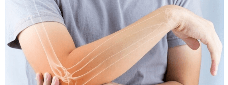 Lateral Epicondylitis (Tennis Elbow)