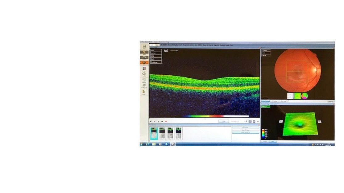 Penny & Hayter Opticians | local opticians