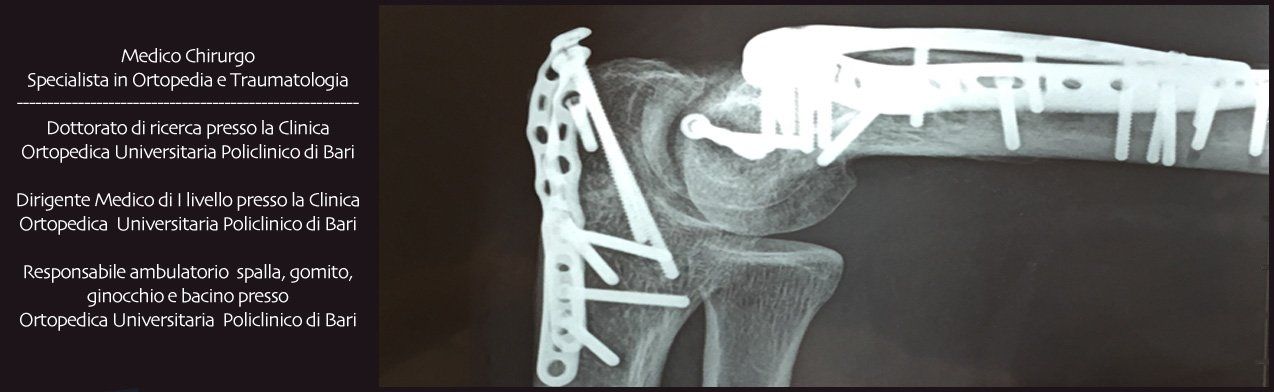 Chirurgo ortopedico | Bari, BA | Panella Dr. Antonio