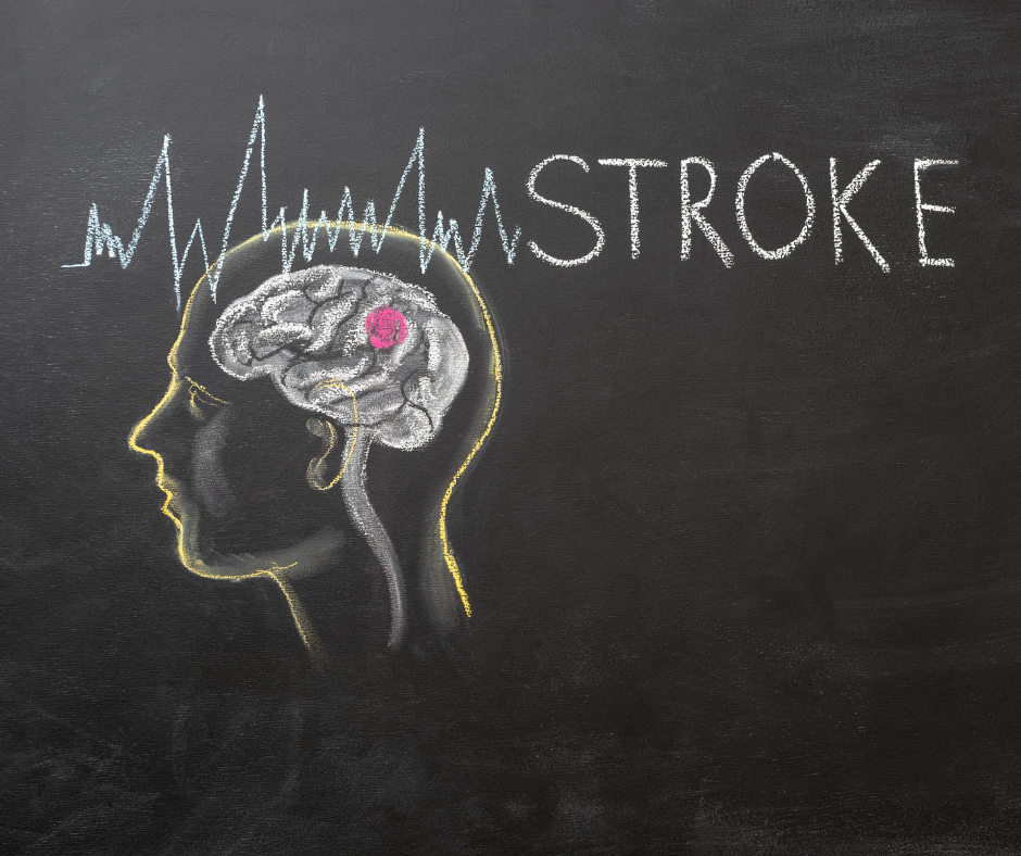 BE FAST: Recognizing Stroke Symptoms and Why Every Second Counts