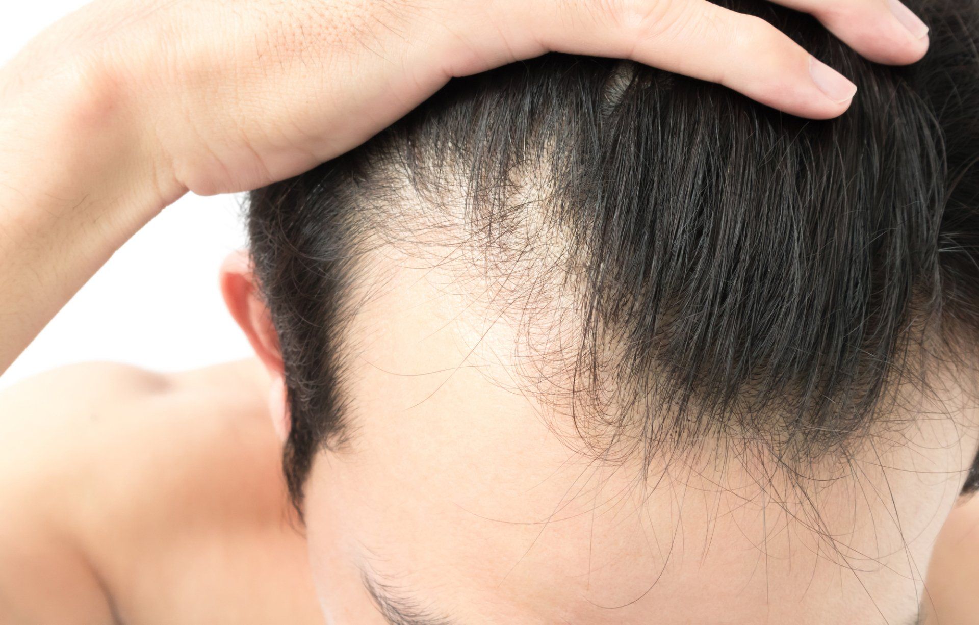 Does Lack Of Protein Cause Hair Loss 