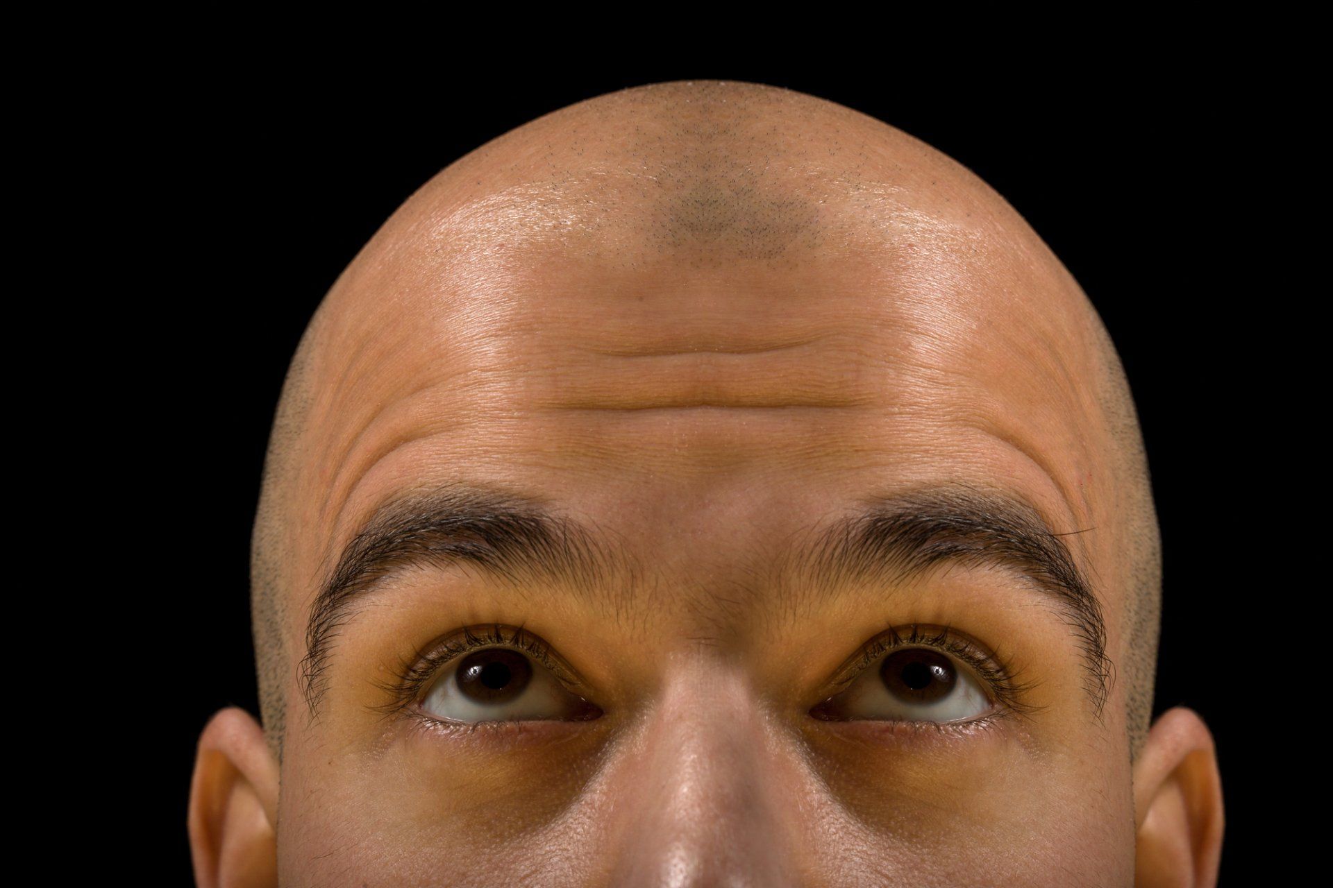 Making A Bald Head Less Shiny