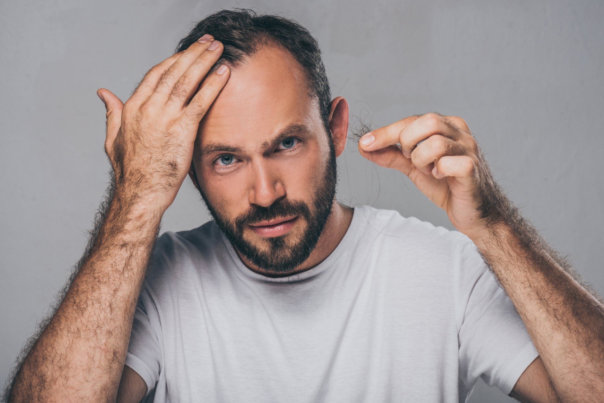 Understanding The Average Age Of Hair Loss Solutions