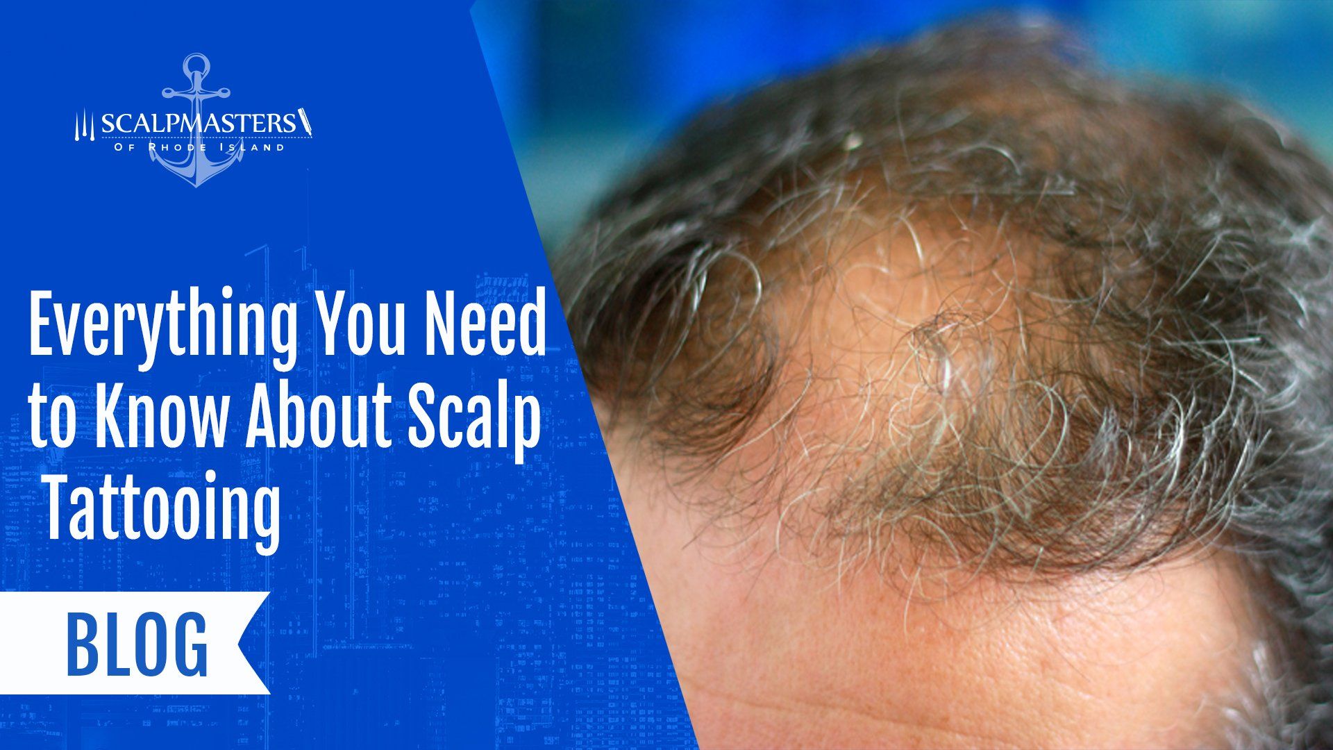 The Best Guide to Hairline & Scalp Tattooing