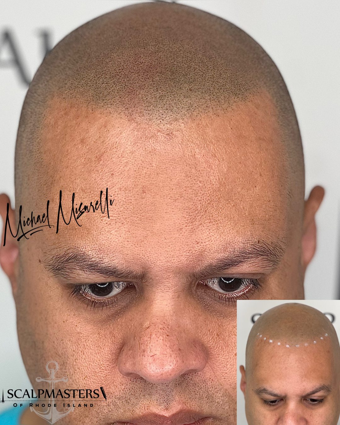 Learn hair pigmentation basics at Scalp Masters RI