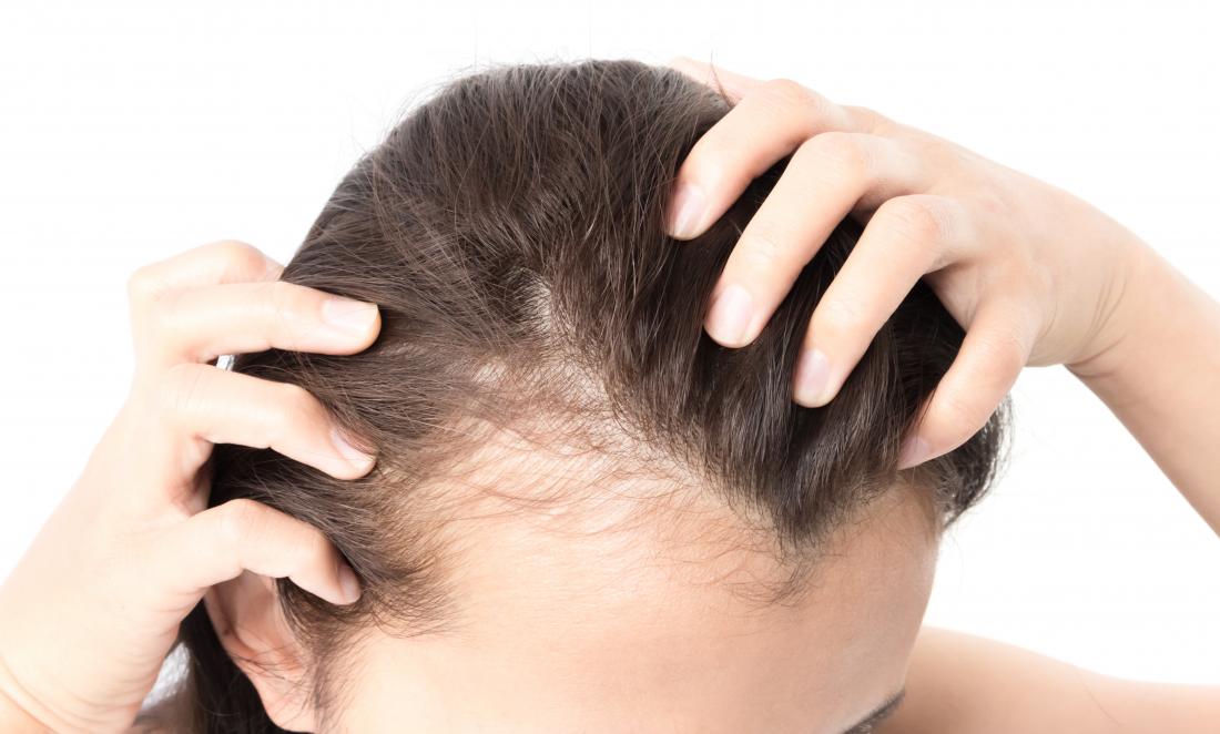 Humira Hair Loss: Can Humira Cause Hair Loss?