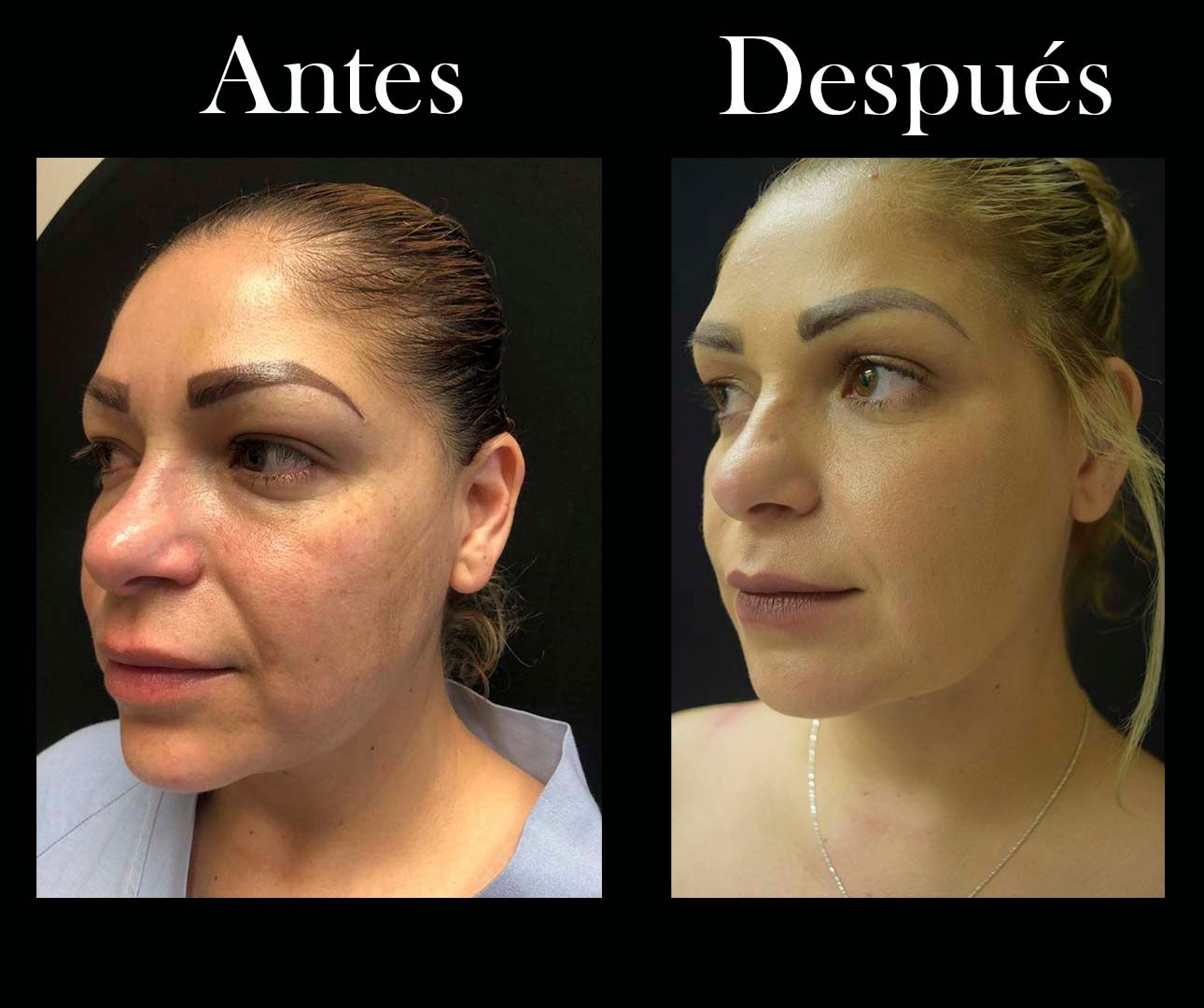Plastic Surgeon in Mexico | Galvan Plastic Surgery Institute