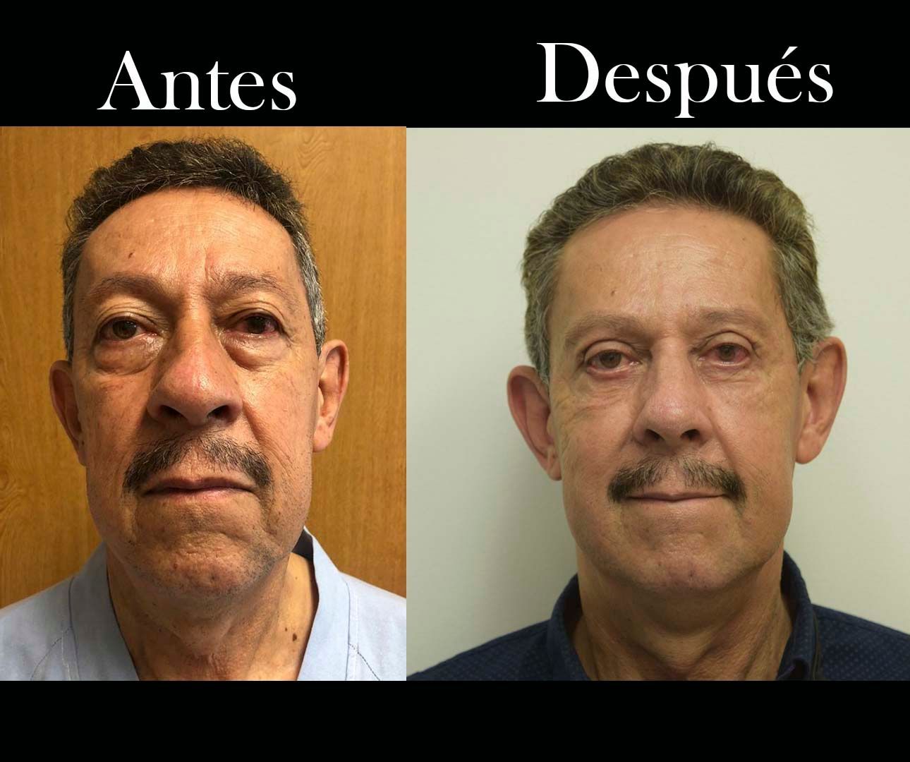 Plastic Surgeon in Mexico | Galvan Plastic Surgery Institute