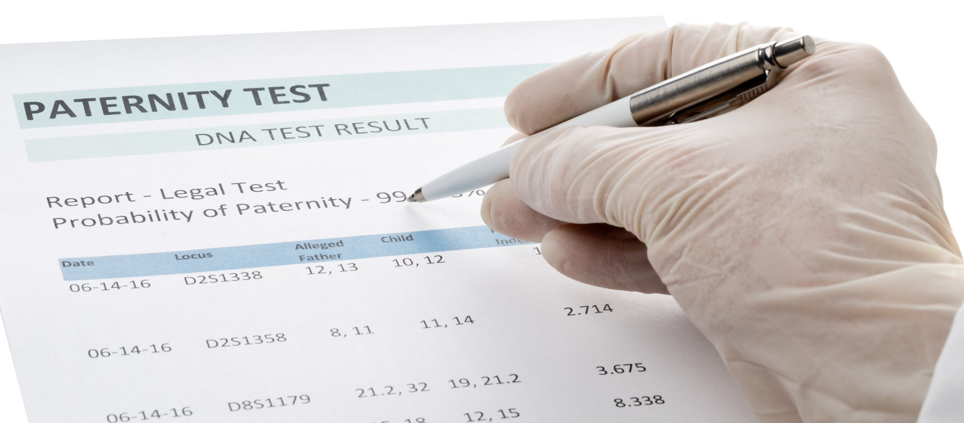 Questions and Answers About DNA Testing For Paternity