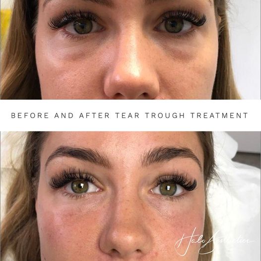 Aesthetics clinic photo guide | Milton Keynes