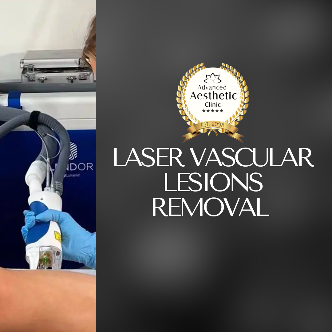 Laser Specialist – Advanced Aesthetic Wexford