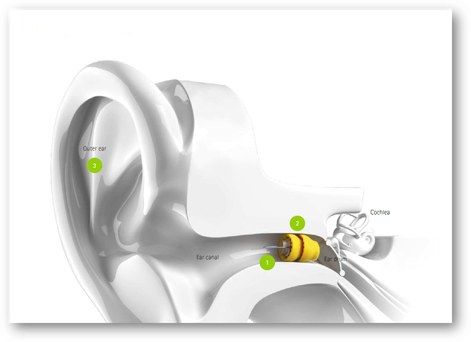 Invisible Hearing Aids for Launceston | Abel Hearing Clinic