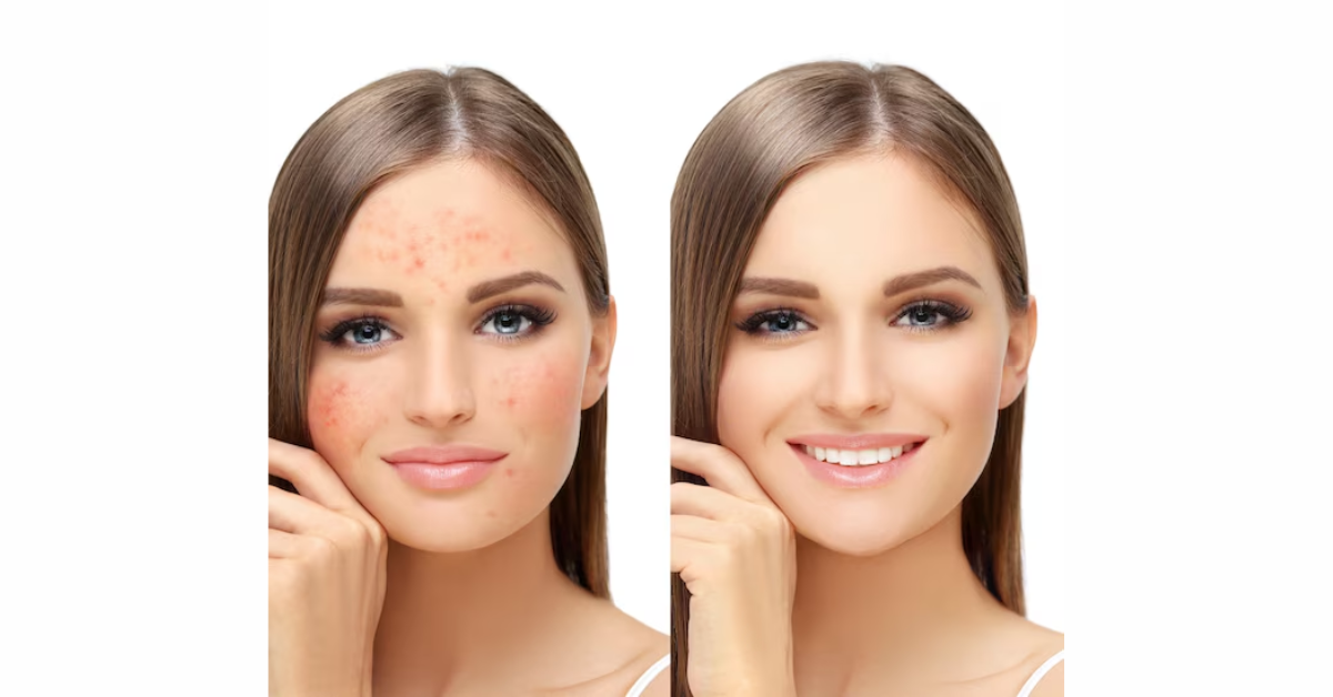 How Is Skin Pigmentation Diagnosed? Expert Insights & Methods