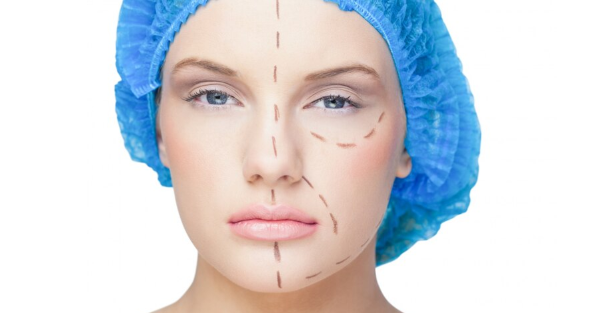 What Is a Non-Surgical Face Lift? A Complete Guide