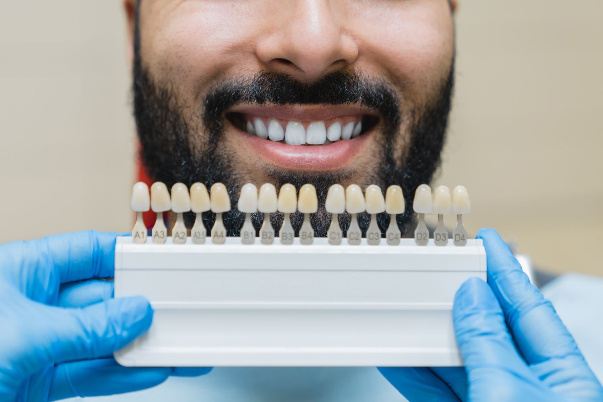 Veneers V. Bridges: Which Is Right for Me? | Royal Dental