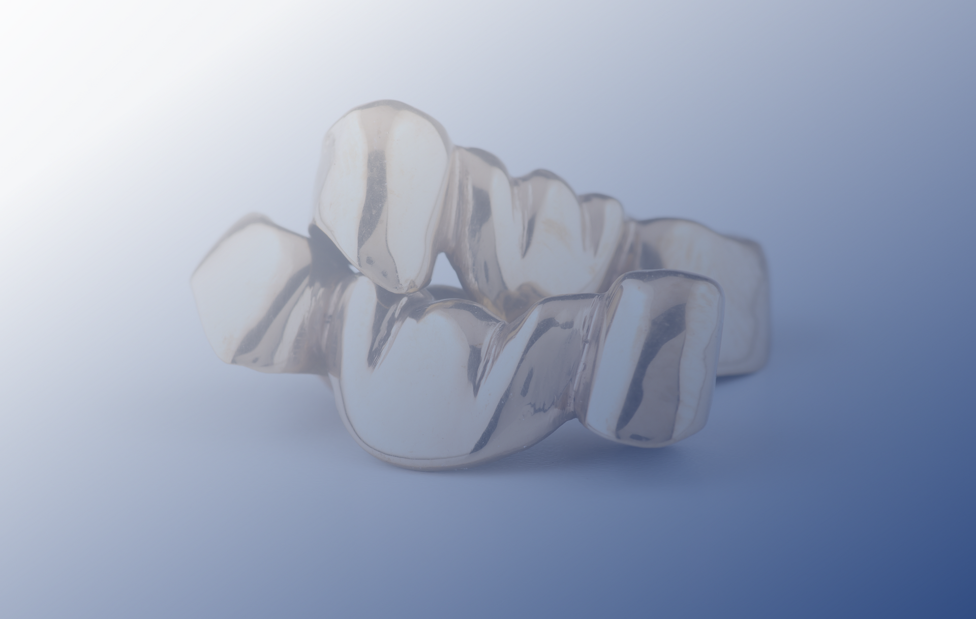 Why metal crowns are a gold standard for strength and longevity.