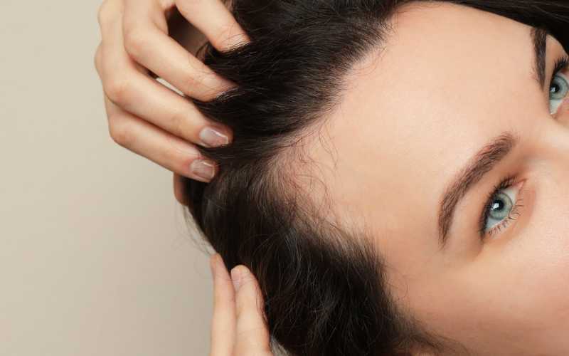 Guía para Bajar la Línea de Cabello