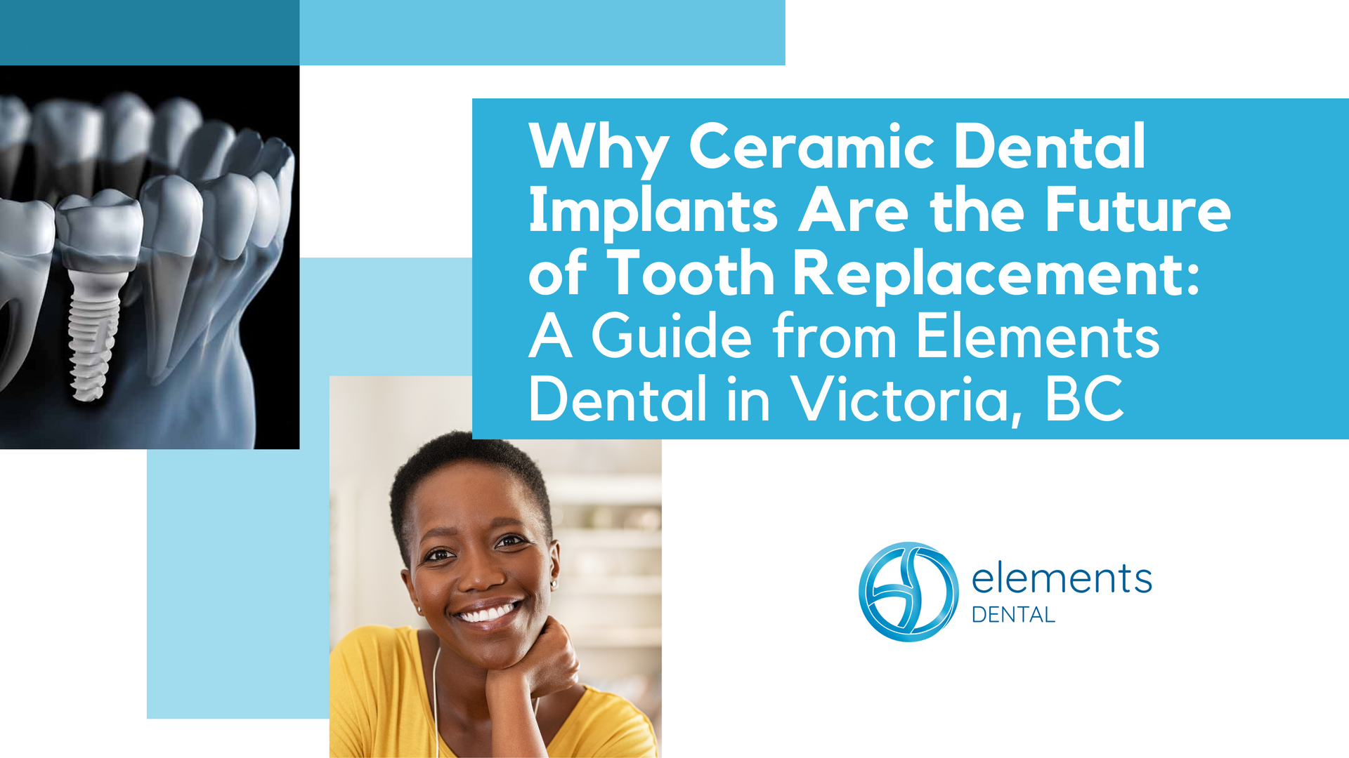 Why Ceramic Dental Implants Are the Future of Tooth Replacement: A Guide from Elements Dental in ...