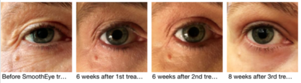 Biostimulatie voor een gezonde huid