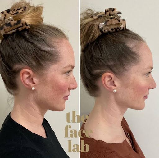 Skin & Face Aesthetic Treatment Clinic | Toronto | The Face Lab