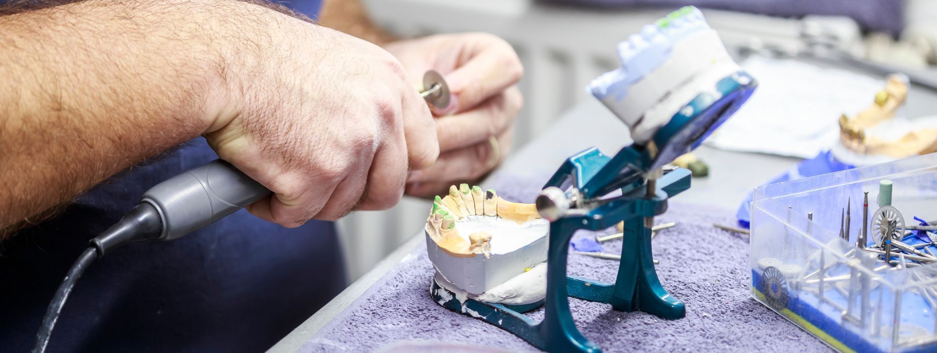 Choosing the Right Dental Lab for Your Practice
