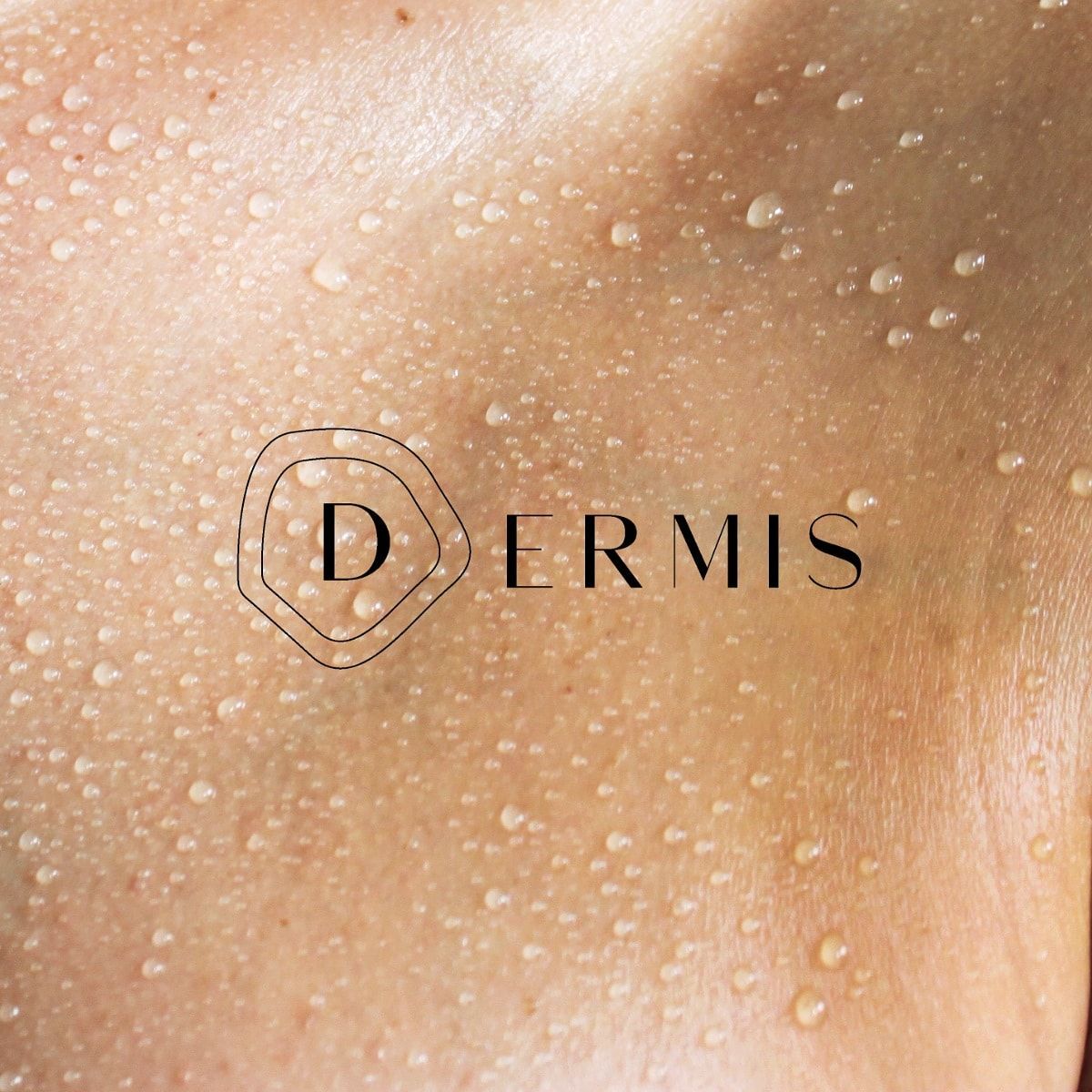 Dermis - Huidverbetering met micro needling en mesoestetic peelings