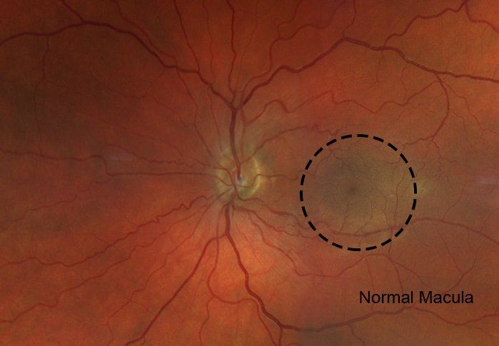 Eye Surgeons Brisbane