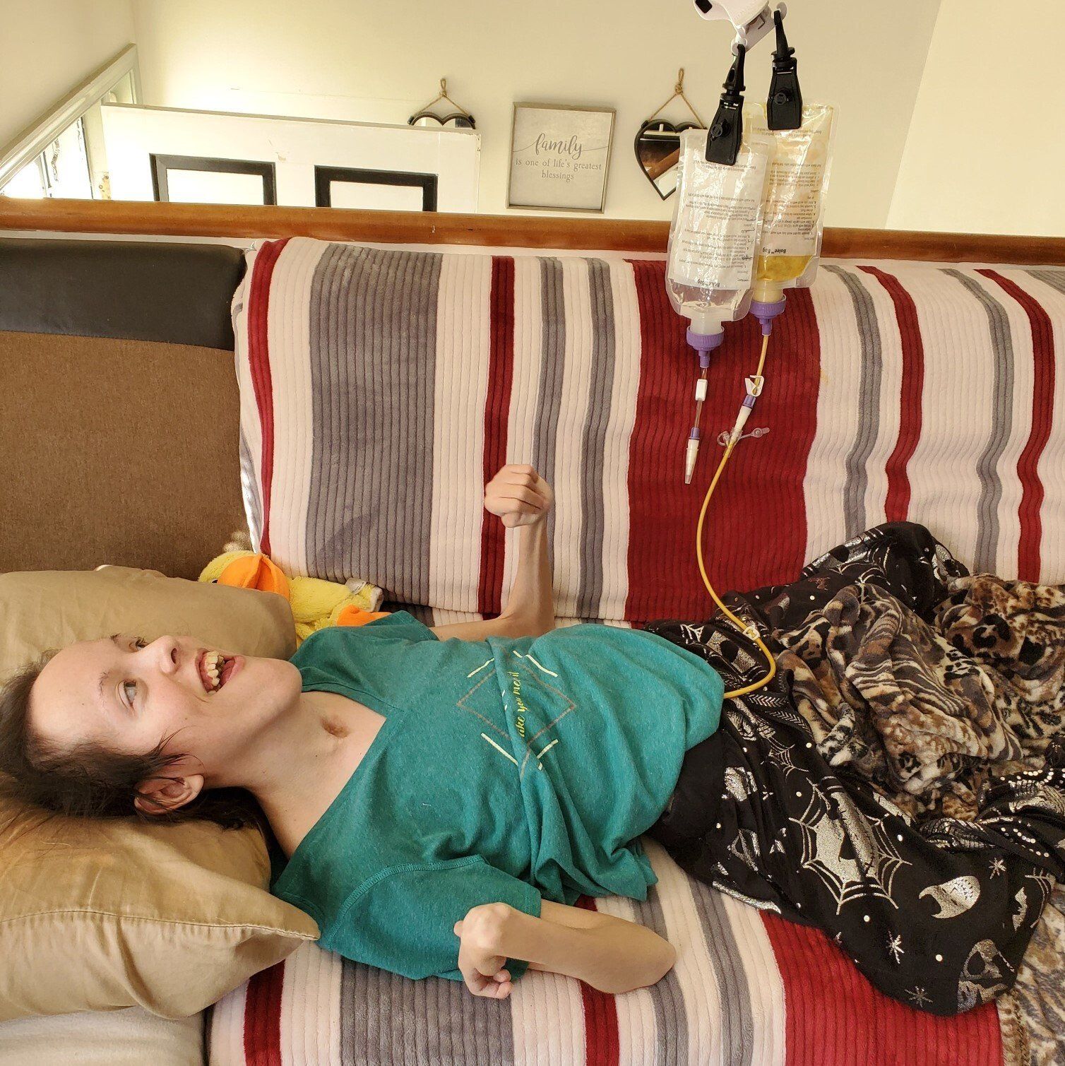 The bFed® System as a Closed System - Keeping Clean During Prep