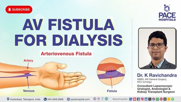 AV Fistula for Dialysis – Expert Insights by Dr K Ravichandra