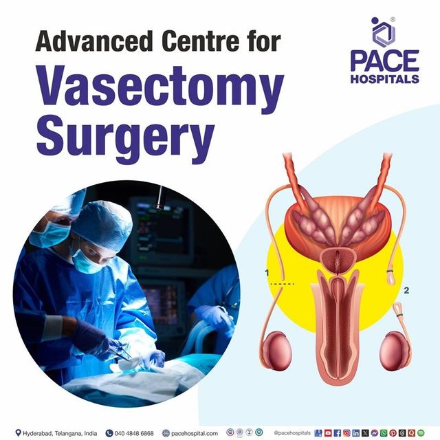vasectomy procedure code