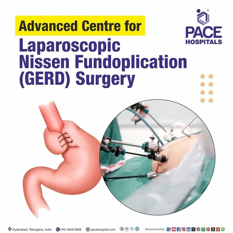 Best Laparoscopic Fundoplication Surgery in Hyderabad, India