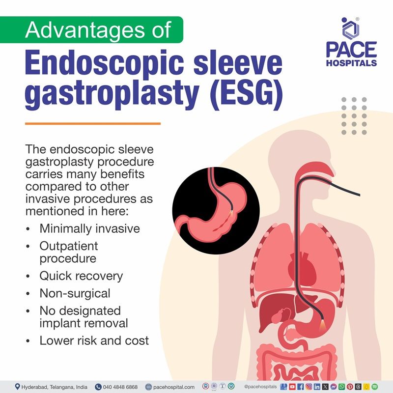 Endoscopic Sleeve Gastroplasty in Hyderabad - Cost & Benefits