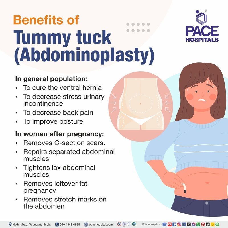 Best Tummy Tuck Surgery in Hyderabad, India | Cost & Benefits