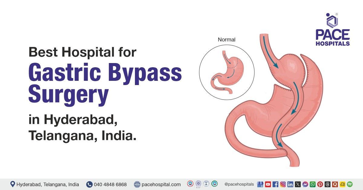 Best Hospital for Gastric Bypass Surgery in Hyderabad, India