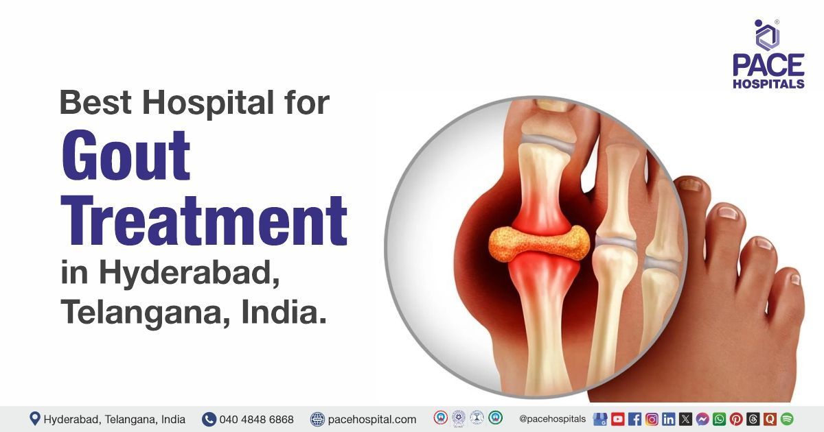 Best Hospital for Gout Treatment in Hyderabad, India