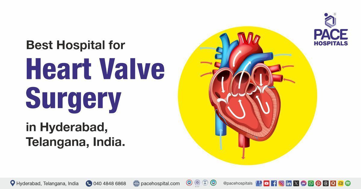 Best Hospital for Heart Valve Surgery in Hyderabad, India