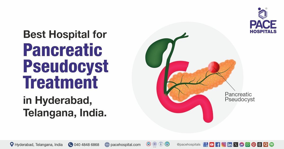 Best Hospital for Pancreatic Pseudocyst Treatment in Hyderabad