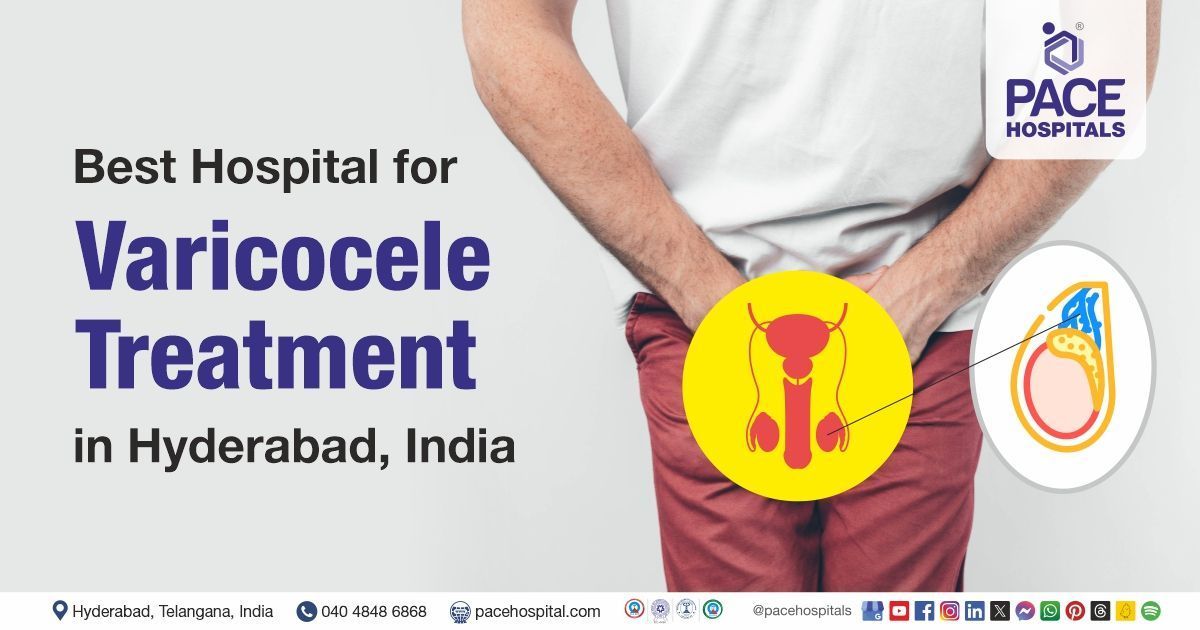 Best Hospital for Varicocele Treatment in Hyderabad, India