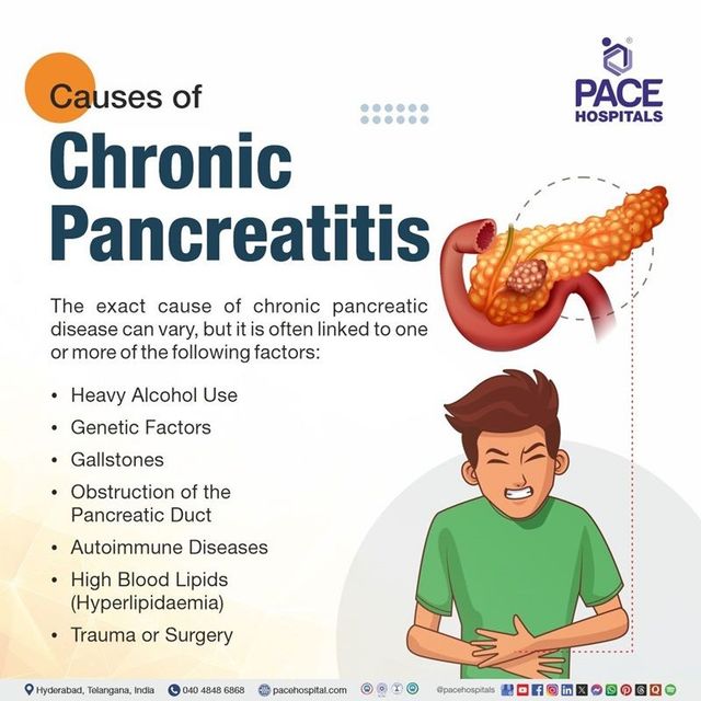 Pancreatitis Causes