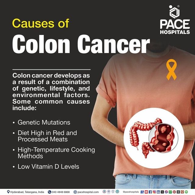 Colon Cancer Symptoms