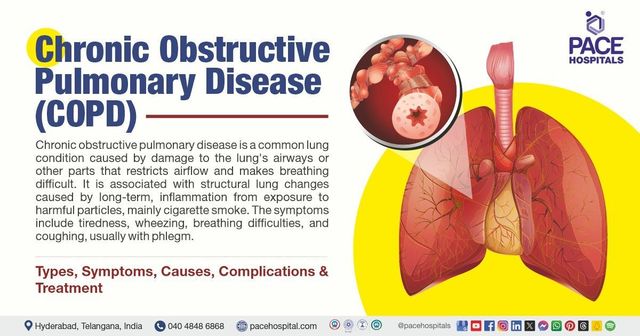 Emphysema Definition Symptoms Causes Diagnosis Types Stages EMPHYSEMA,