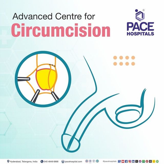 Types Of Circumcision Cuts