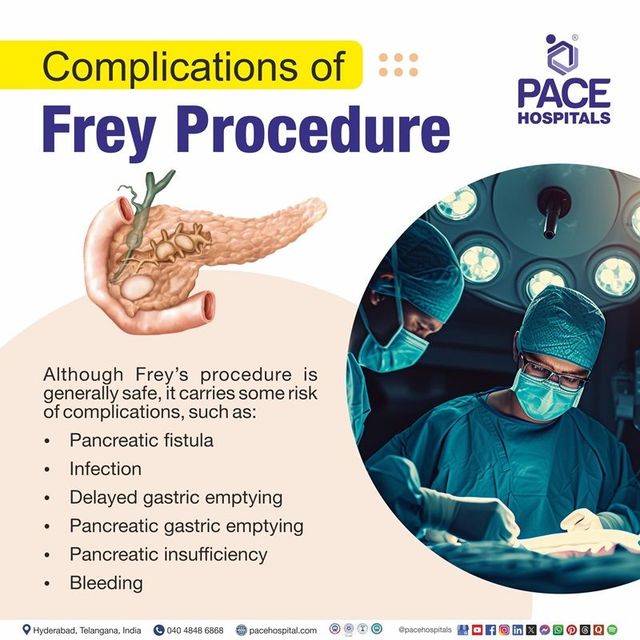 Puestow Procedure Complications