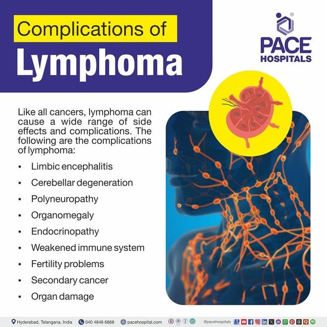 Hodgkins Lymphoma Divine Consciousness